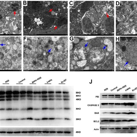 Mitochondrial Oxidative Phosphorylation Induced Apoptosis May Result In