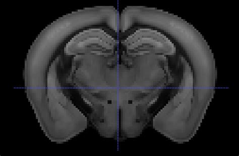 How To Switch Between The 3 Coordinate Systems Of Mouse Connectivity Technical Allen Brain