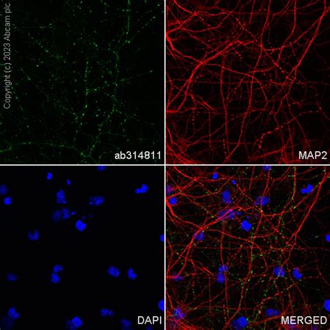 Map2抗体[hm 2] Neuronal Marker Ab11267 Abcam中文官网