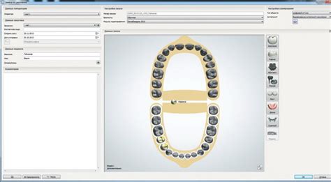 Model Builder Crack From 3shape A Simple Way From A Digital Impression To A Collapsible Model