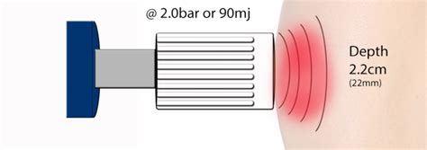 Shockwave Theory Shockwave Therapy