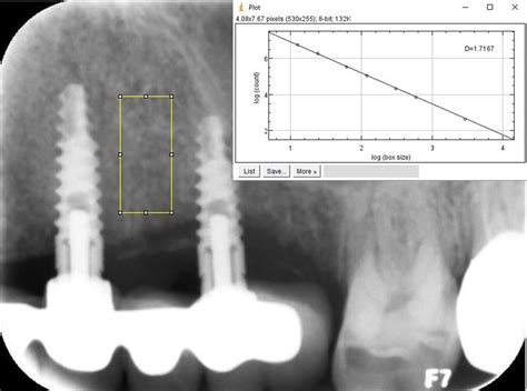 Fractal Analysis Of The Image Shown In Figure 2b Fractal Dimension D