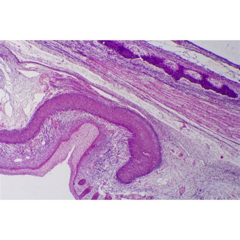 Bone Development Intermembranous Vertical Ls Of Foetal Skullcap