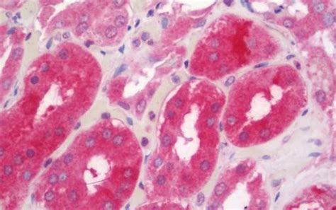 Ikbkg Nemo Ikk Gamma Antibody Aa51 100 Rabbit Polyclonal Antibody Wb Ihc P If E Buy