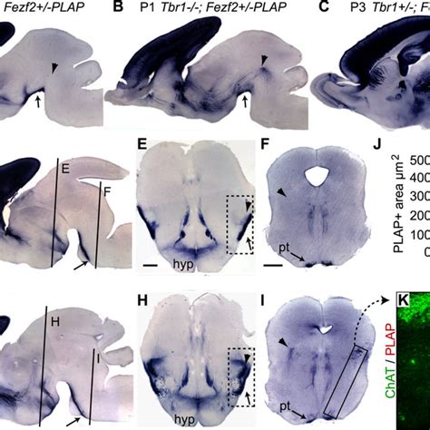 Tbr1 And Ctip2 Expression In Corticothalamic And Subcerebral Projection Download Scientific