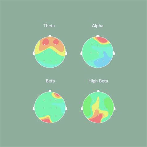 QEEG Brain Mapping Brain Bloom