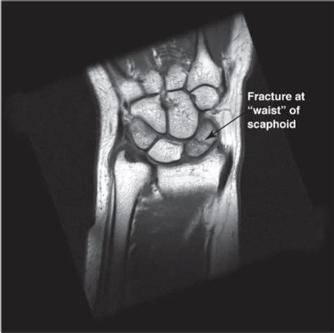 Msk Dx Flashcards Quizlet