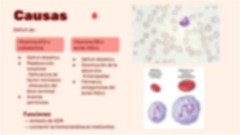 Solution Anemia Megaloblastica Studypool