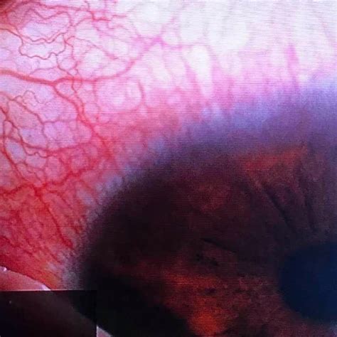 Ocean Optical Ocean Optical Added A New Photo — In Abstract Artwork Abstract Artwork