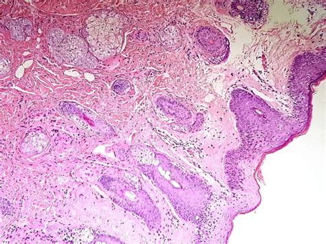 Colorazione Ematossilina Eosina Metodo Rapido Diapath