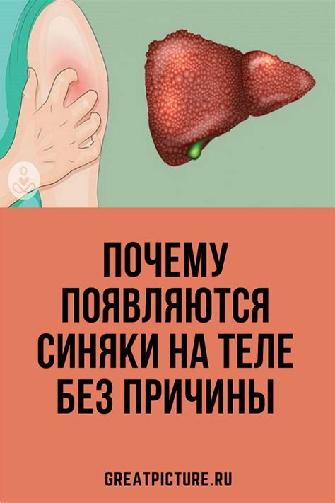 Почему появляются синяки на теле без причины | Здоровье, Тело, Мотивация