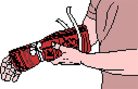 Emergencies And First Aid How To Splint A Fracture Harvard Health