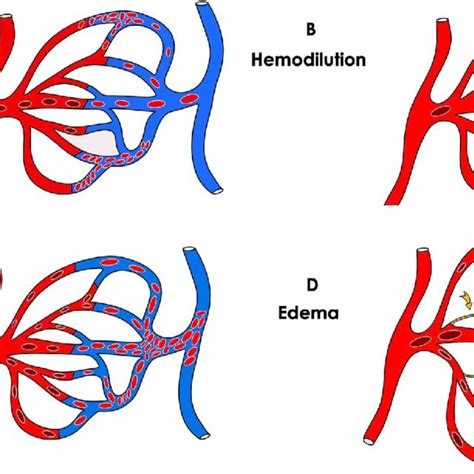 Illustration Of The Different Types Of Microvascular Alterations Download Scientific Diagram