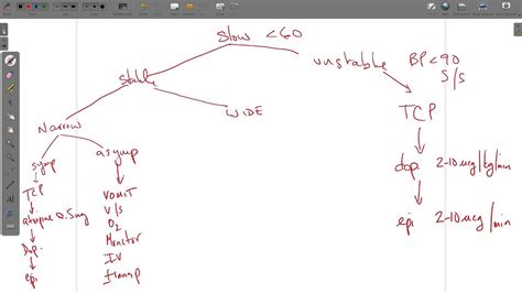 Ecg Treatment Decision Tree Youtube