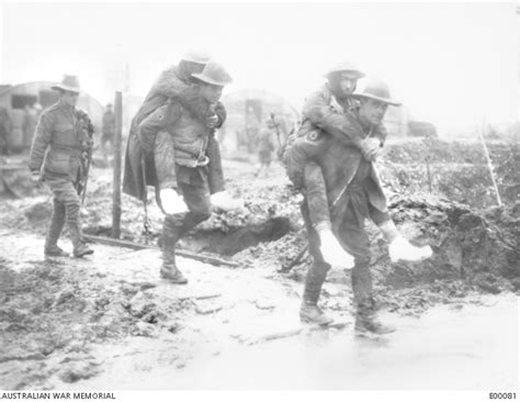 1918 Trench Warfare Hell On Earth Australian War Memorial