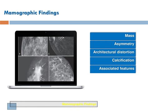 Mammography Ppt Download