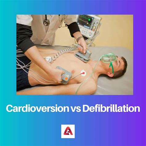 Cardioversion Vs Defibrillation Difference And Comparison