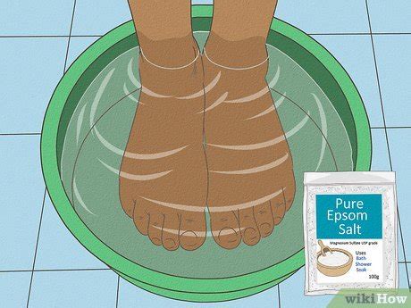 3 Ways To Get Rid Of Calluses WikiHow 3 Ways To Get Rid Of Calluses WikiHow