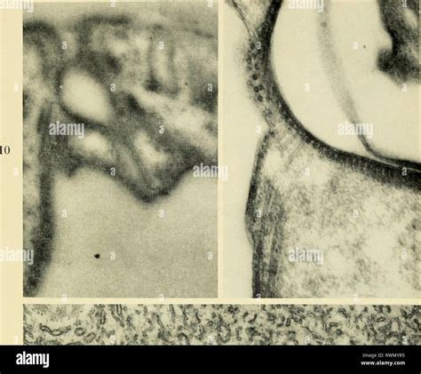 Electron Microscopic Structure Of Protozoa 1963 Electron Microscopic Structure Of Protozoa