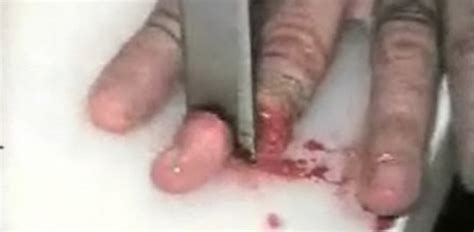Se Graba Cortandose Un Dedo