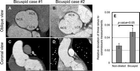 The Difference Of The Measurements In The Different Cusps Increases In Download Scientific
