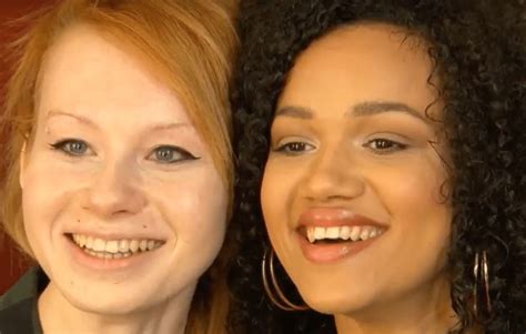 The Remarkable Story Of Lucy And Maria Aylmer Twins Defying Genetic