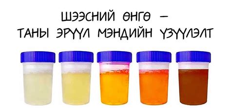 Шээсний өнгө ямар байгаагаар эрүүл мэндээ тодорхойлж болно · Dorgio Mn