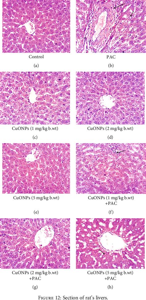 Figure 12 From Biosynthesis Of Copper Oxide Nanoparticles Using Streptomyces Mhm38 And Its
