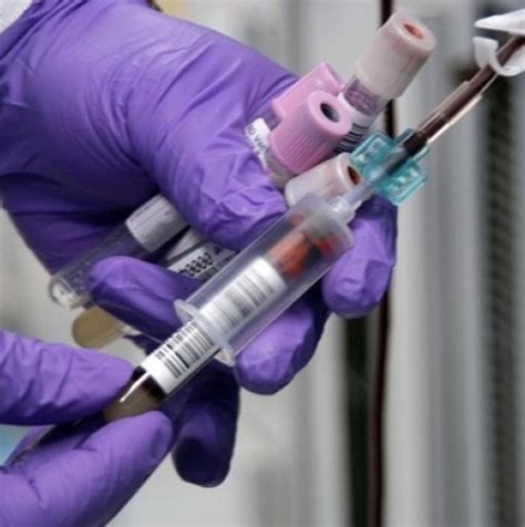 Разчитане на кръвни изследвания и референтни стойности За Жената