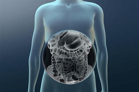 Intestinal Dysmotility Treatment At Mercy In Baltimore Md