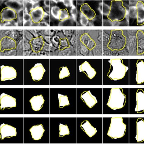 Comparisons Between Machine And Manual Segmentation Results Image