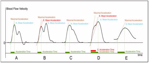 Pulses By Doppler At William Fellows Blog