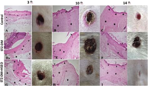 Macroscopic And Histopathological Image Of The Scar Tissue In All