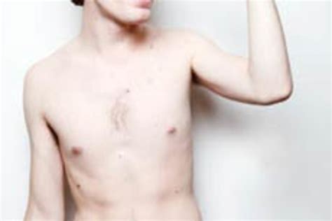 Are Cox Blockers The New Steroids Discover Magazine