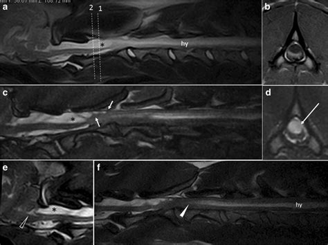 Two Year Old Male Boxer Left Dorsolateral Cervical Septate Arachnoid