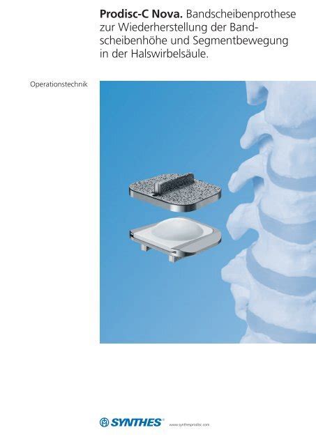 Prodisc C Nova Bandscheibenprothese Zur Synthes