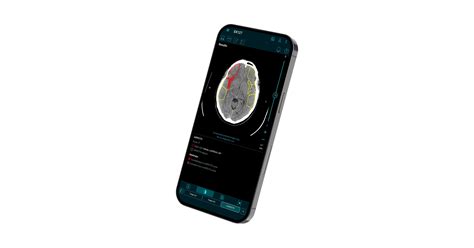 Brainomix Targets Us Expansion With The Launch Of Its Cutting Edge