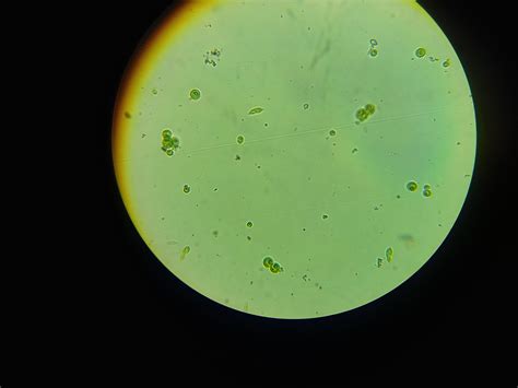 Can An Expert Please Give Me Advice On This Specific Microalgae Identification Researchgate