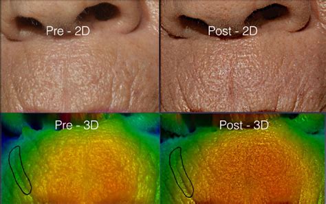 Patient Randomised As The Negative Control The Black Contour Delimits Download Scientific