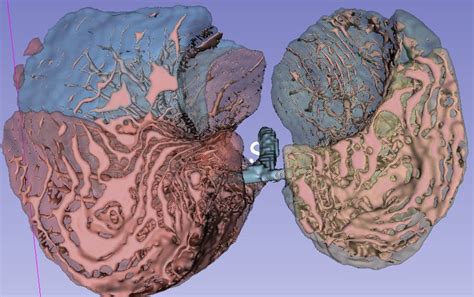 lung segmentation with lungctsegmenter support 3d slicer community