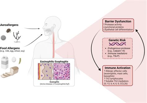 Breaking Down The Complex Pathophysiology Of Eosinophilic Esophagitis Pmc