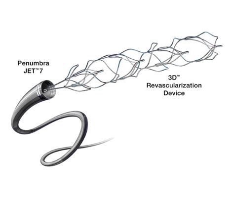 Devicemd 3d Revascularization Device™