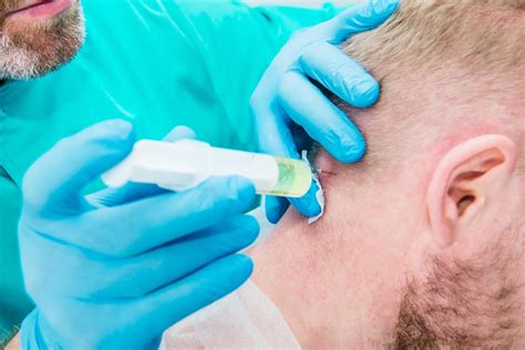 Pulsed Radiofrequency To The Occipital Nerves Total Pain Clinic