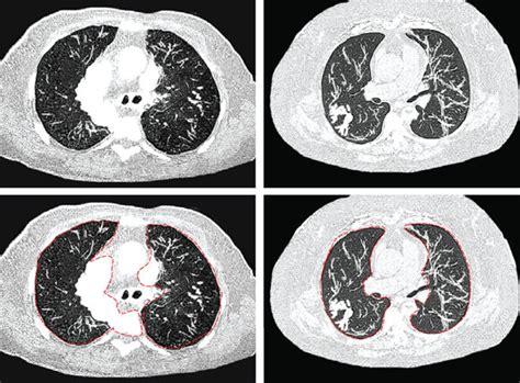 Comparison Of The Segmentation Effect Of Single Threshold Segmentation