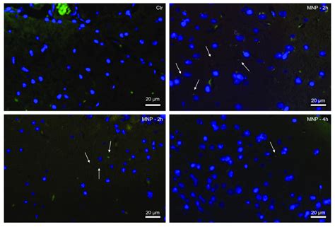 Nanometer Scale Ps Plastic Particles Were Detected In Mouse Brain Only