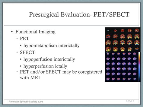 Ppt Epilepsy Surgery Powerpoint Presentation Free Download Id5441164