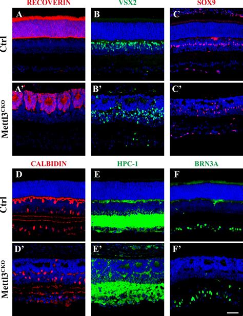 Figures And Data In M6a Epitranscriptomic Modification Regulates Neural