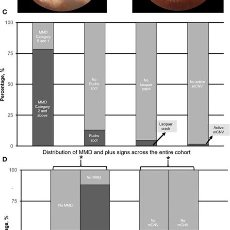 A And B Are The Representative Fundus Photograph Of A Myopic Download Scientific Diagram