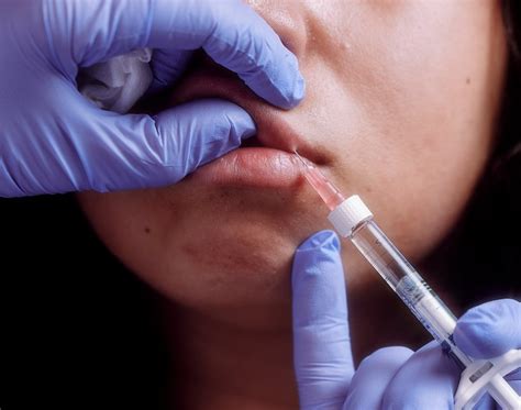 ژل لب مدل کره ای، هر آنچه باید بدانید