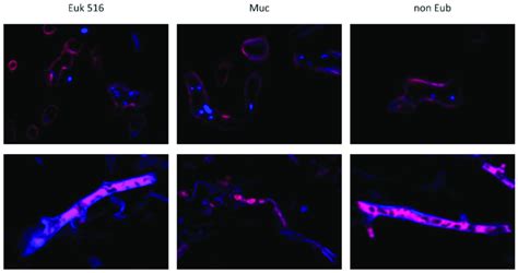 Unspecific Fluorescence Patterns In Clinical Samples With Proven